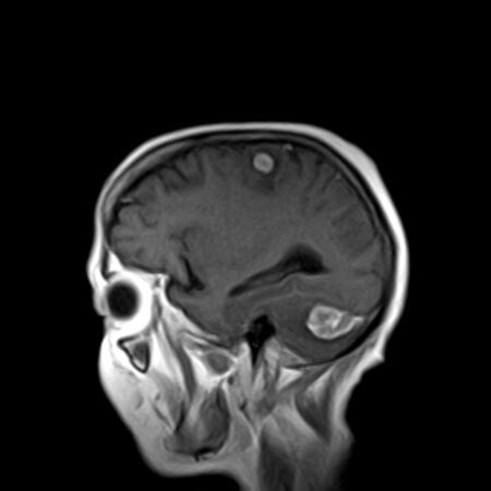 ام آر آی مغز چیست و چرا انجام می شود؟ | مرکز تصویربرداری دکتر قائمیان