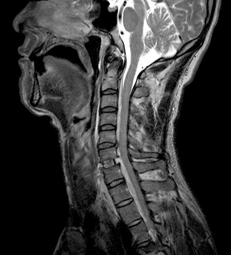 انواع دستگاه ام آر آی (MRI) | مرکز تصویربرداری پزشکی دکتر قائمیان